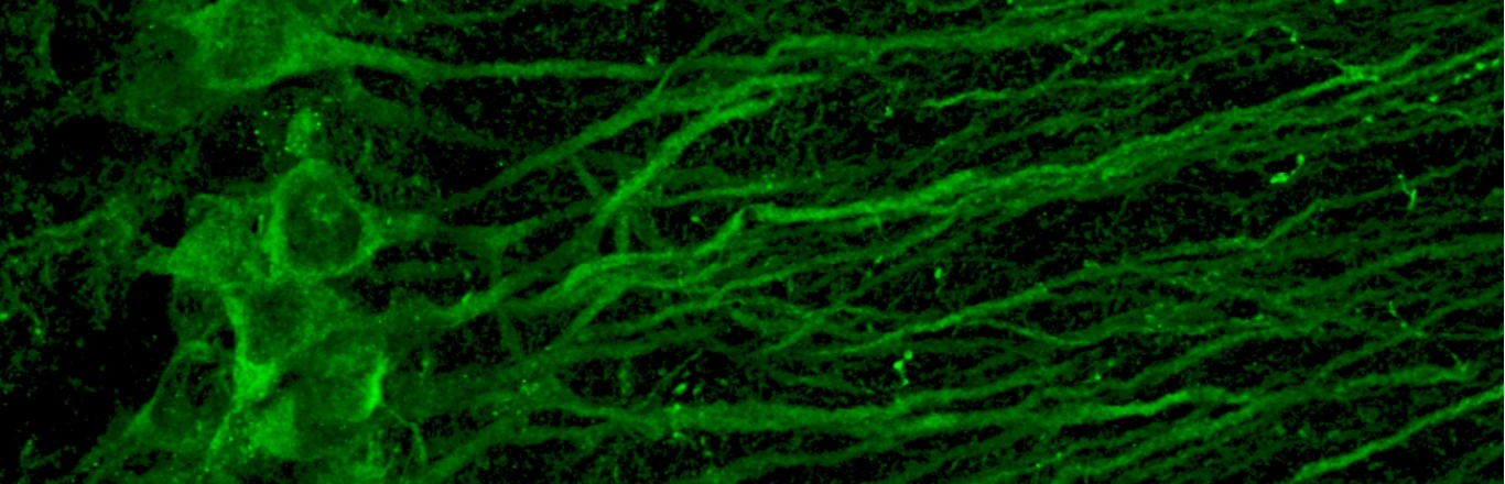 Research | MRC Harwell