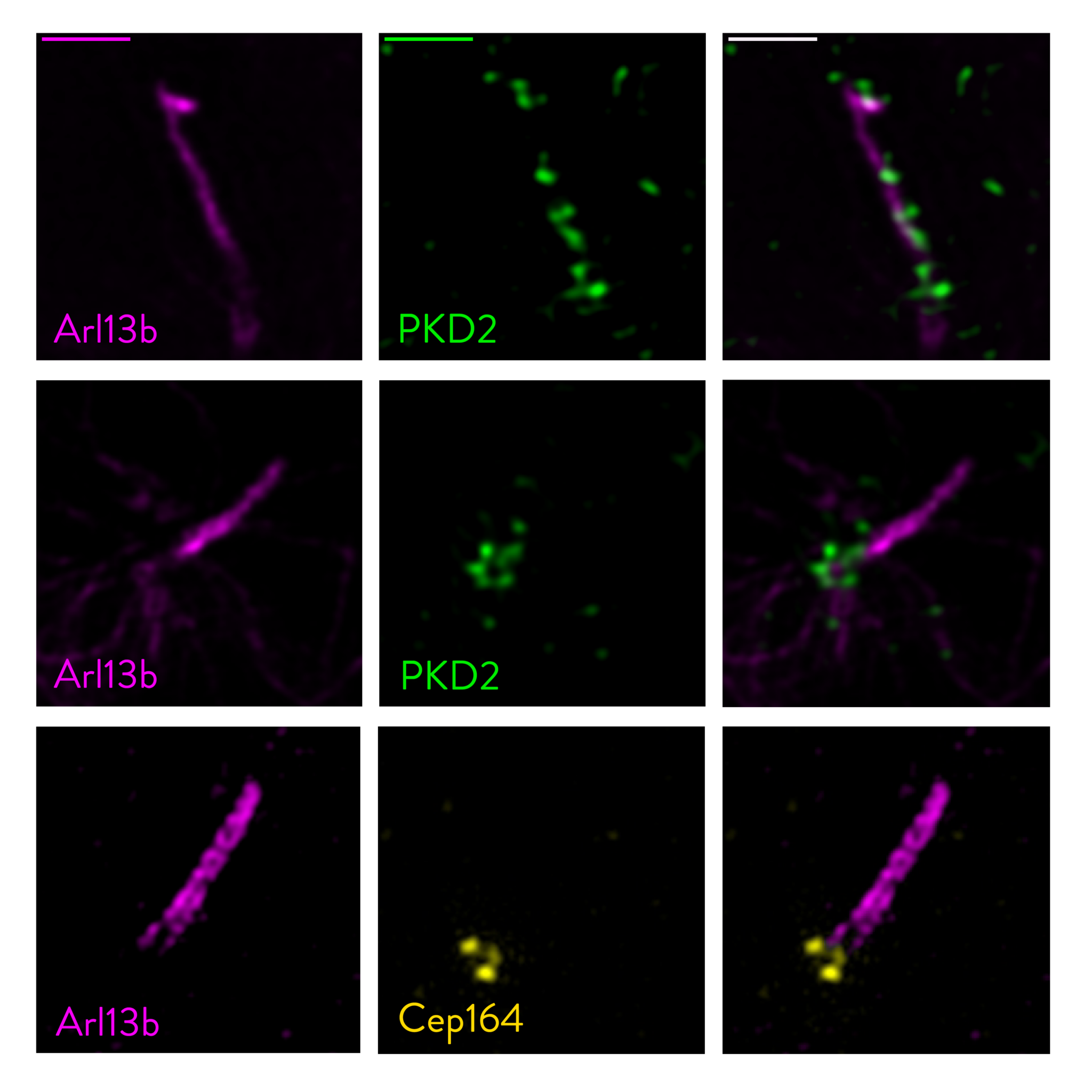 Ciliary exclusion of Polycystin-2 promotes kidney cystogenesis in an ...